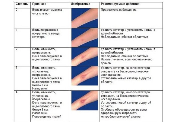 Уход за пациентами с катетерами, зондами